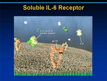 The Role of IL-6 in Inflammatory Diseases (Slides with Transcript)
