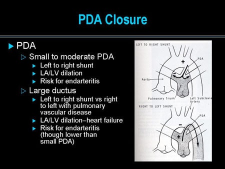 The Role of Interventional Cardiology in CHD (Slides with Transcript)