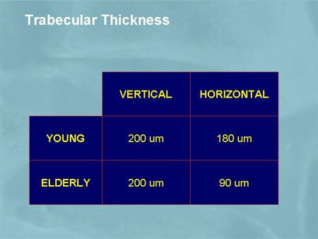 Qualities of Bone and the Effects of Treatment (Slides with Transcript)