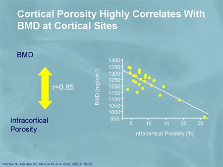Qualities of Bone and the Effects of Treatment (Slides with Transcript)