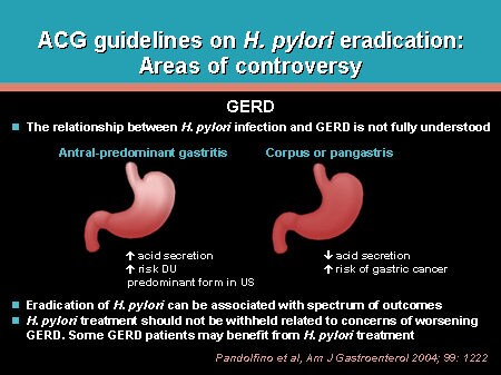H. pylori Eradication: What Are the New "Must-Know" Points? (Slides ...