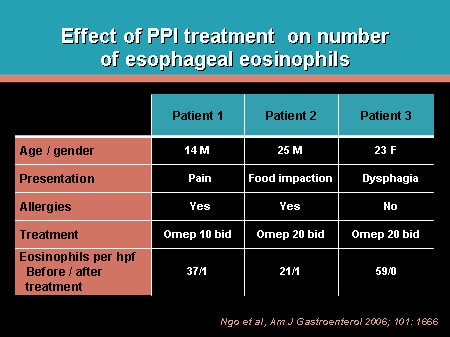Eosinophilic Esophagitis: More Than Child's Play! (Slides with Transcript)