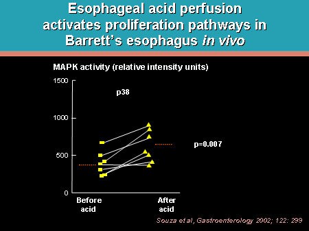 Barrett's Progression and Regression: From Concepts to Clinical ...