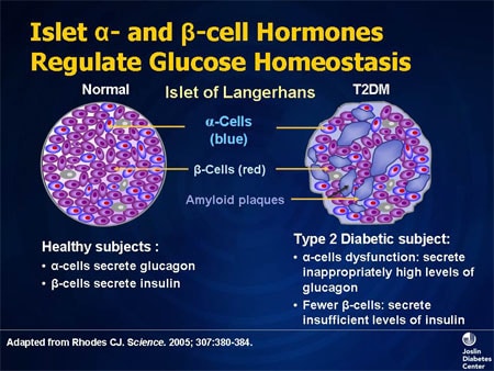 The Pathophysiology of Type 2 Diabetes: New Perspectives and Their ...