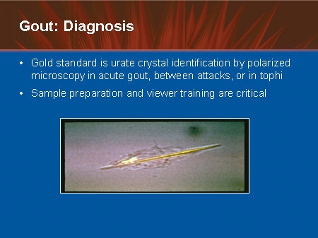 Accurate Diagnosis and Appropriate Management of Recurrent and ...