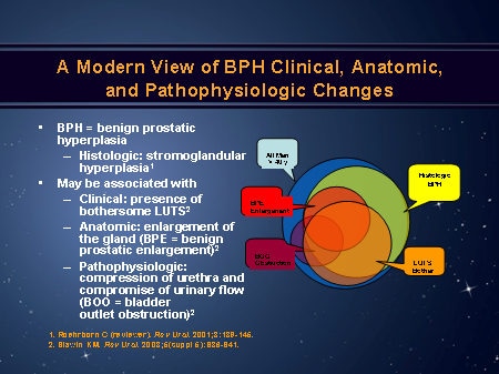 Male LUTS, BPH, BOO, BPE/EP Update 2007 (Slides with Transcript)