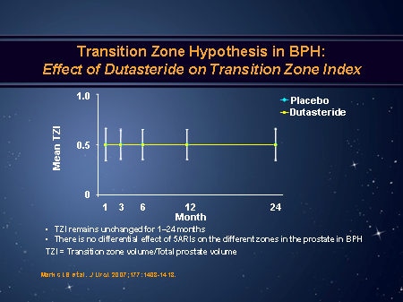Male LUTS, BPH, BOO, BPE/EP Update 2007 (Slides with Transcript)
