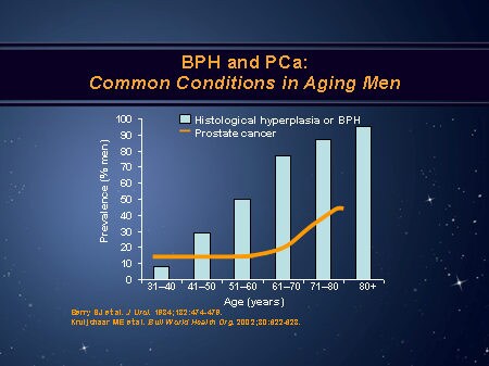 Male LUTS, BPH, BOO, BPE/EP Update 2007 (Slides with Transcript)