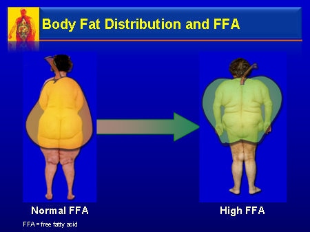 The Impact of Obesity on Type 2 Diabetes: The Role of Visceral Fat ...