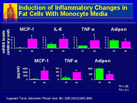 The Impact of Obesity on Type 2 Diabetes: The Role of Visceral Fat ...