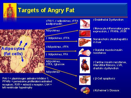 The Impact of Obesity on Type 2 Diabetes: The Role of Visceral Fat ...