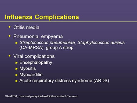 Update on Treatment of Influenza (Slides With Transcript)