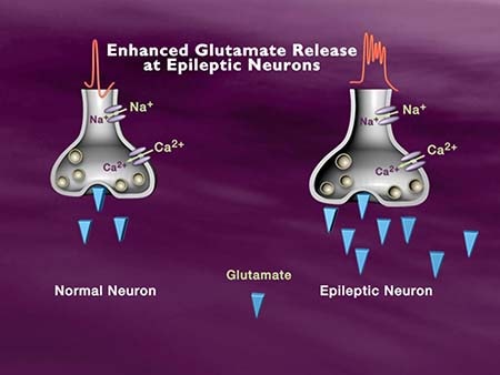 The Role of Potassium Channel Ions in Epilepsy (Slides With Transcript)