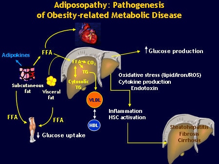 Obesity as a Chronic Disease: Epidemiology, Morbidity, and Mortality ...