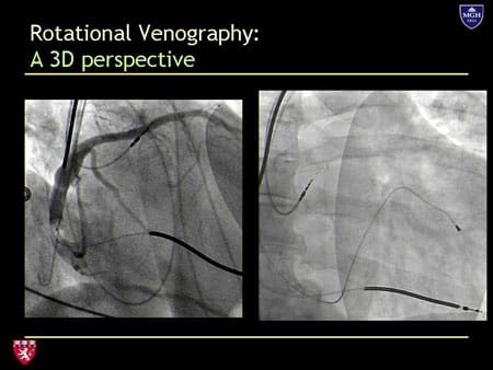 Device Therapy for Heart Failure: What's New on the Horizon?