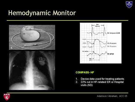 Device Therapy for Heart Failure: What's New on the Horizon?