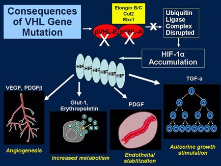 Targeted Therapies in Advanced Renal Cell Carcinoma (Slides With Transcript)