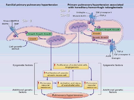 Assessing and Managing Complex Patient Populations in PAH (Slides With ...