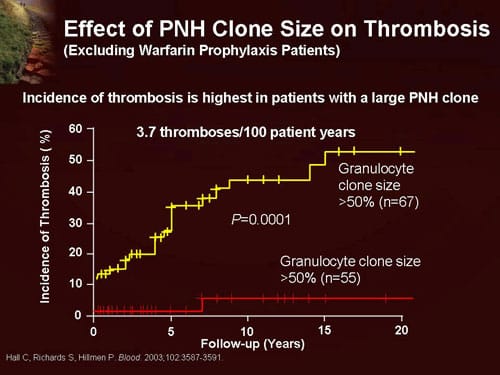Paroxysmal Nocturnal Hemoglobinuria and Thrombosis (Slides With Transcript)