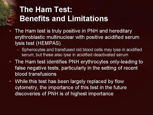 Paroxysmal Nocturnal Hemoglobinuria Diagnosis (Slides With Transcript)