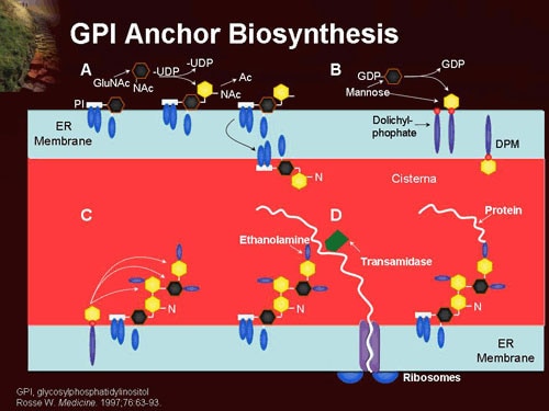 Pathophysiology of Paroxysmal Nocturnal Hemoglobinuria (Slides/Transcript)