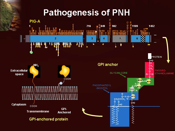 Pathophysiology of Paroxysmal Nocturnal Hemoglobinuria (Slides/Transcript)