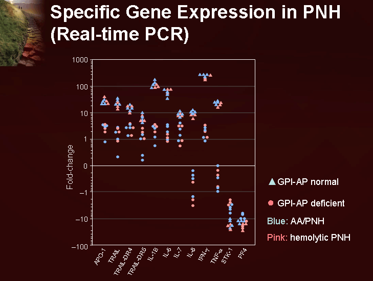 Pathophysiology of Paroxysmal Nocturnal Hemoglobinuria (Slides/Transcript)