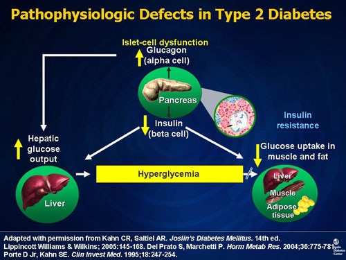Type 2 Diabetes-Pathophysiological Basis for Clinical Therapies(Transcript)