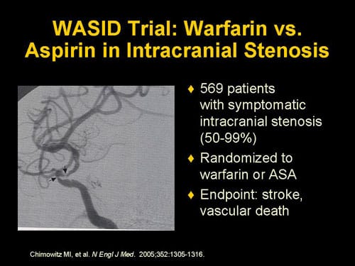 Secondary Stroke Prevention (Slides With Transcript)