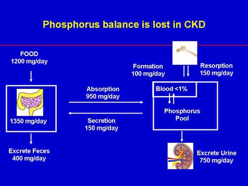 Managing Phosphorus in Chronic Kidney Disease (Slides With Transcript)