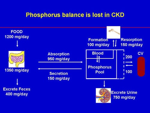 Managing Phosphorus in Chronic Kidney Disease (Slides With Transcript)