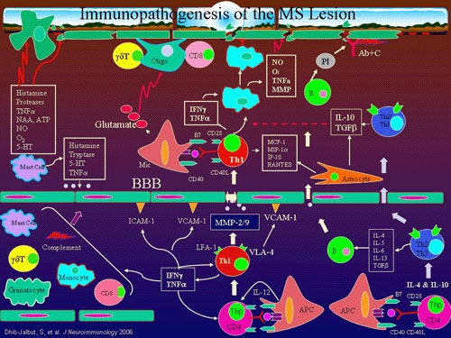 Pathogenesis of MS (Slides With Transcript)