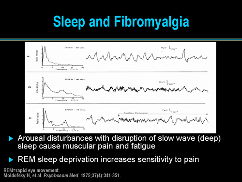 Fibromyalgia: Evidence-Based Tx|Collaborative Optimal Care-Slide/Transcript