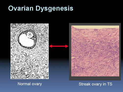 Estrogen, Growth, and Cognition (Slides With Transcript)