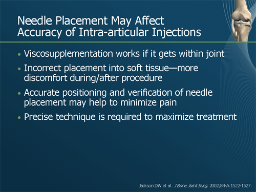 Viscosupplementation for Knee OA: Improving Outcomes (Slides/Transcript)