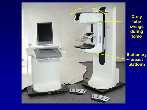 Breast Cancer Screening (Slides With Transcript)