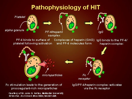 Prevalence, Pathophysiology, and Pharmacotherapy (Slides With Transcript)