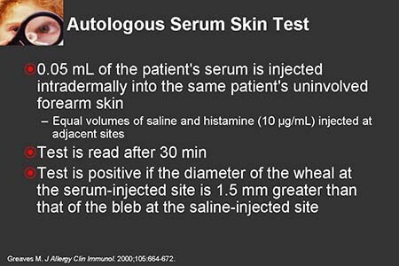 Optimizing Pediatric Diagnosis and Treatment Approaches in CIU ...