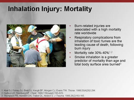 Different Treatment Strategies for Smoke Inhalation in the Burn Unit ...