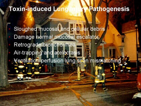 Different Treatment Strategies for Smoke Inhalation in the Burn Unit ...