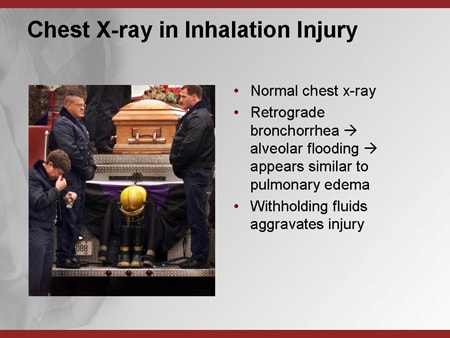 Different Treatment Strategies for Smoke Inhalation in the Burn Unit ...