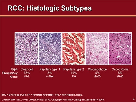 The Evolving Case for Individualized Care in Advanced RCC (Slides With ...