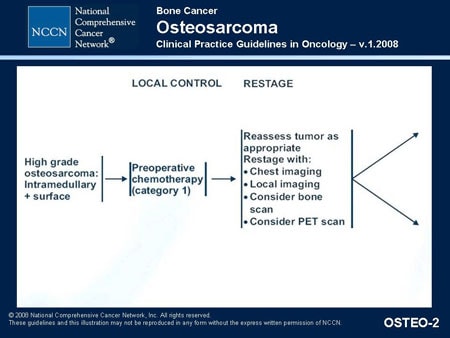Stay Connected: Update on the Management of Sarcoma (Slides With Transcript)