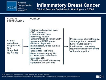 NCCN Breast Cancer Guidelines Update (Slides With Transcript)