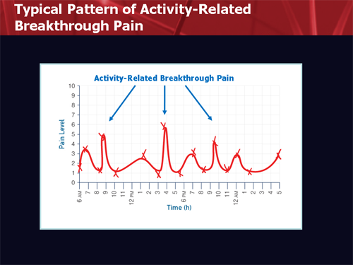 Treatment Landscape for Breakthrough Pain, Cancer (Slides With Transcript)