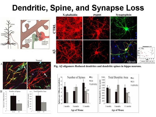 DHA and Dementia: Preserving Cognition in the Aging Patient (Slides ...