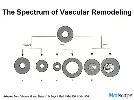 Intrinsic Regulation of Vascular Tone