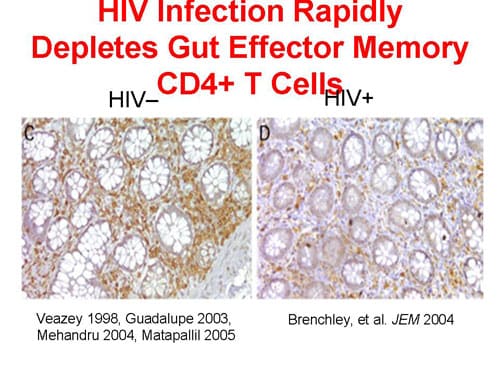 HIV Pathogenesis (Slides With Transcript)