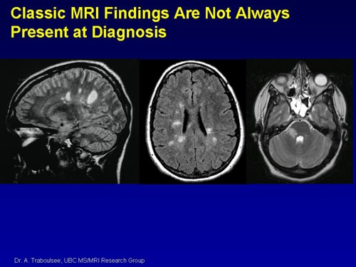 The Multidisciplinary Team in Multiple Sclerosis: Harnessing the Array ...