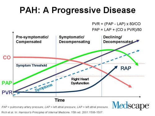 PAH: Diagnostic Challenges and Optimal Therapies (Slides With Transcript)